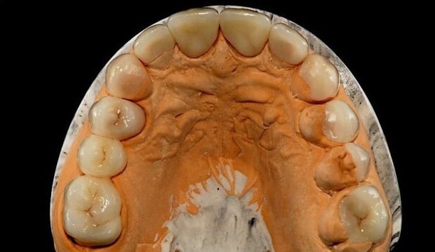 6 Smile Design Cases