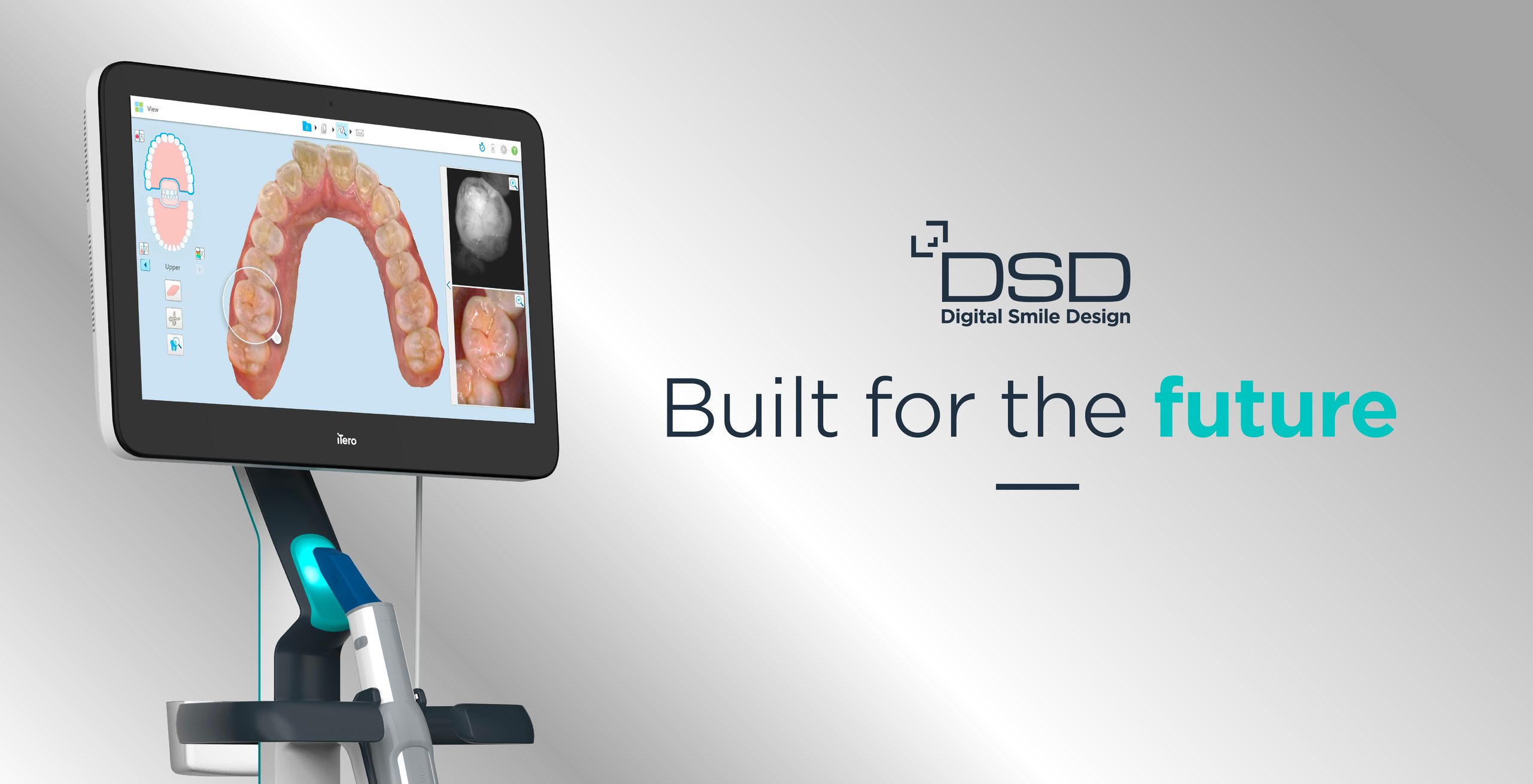 DSD test drives the new iTero Element Plus Series