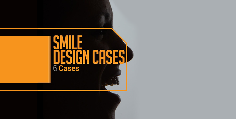 6 Smile Design Cases